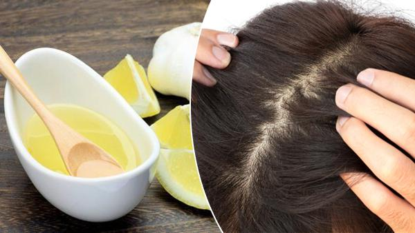 Juain Khatam Karne Ka Asan Totka in Urdu - Remedy, Benefits, Gharelo ...