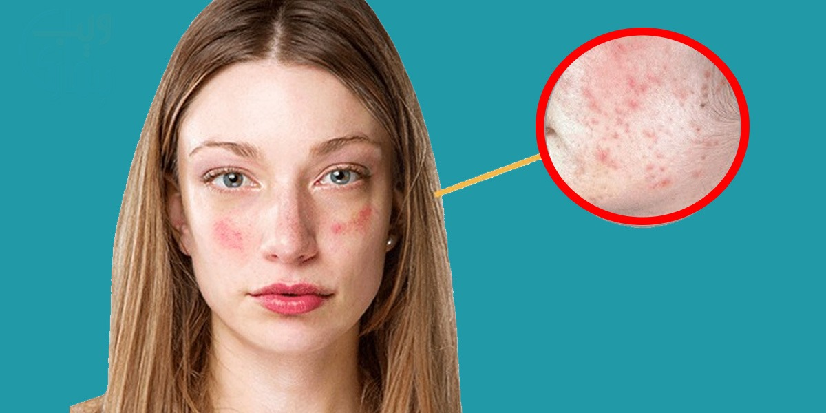 Tip For Sensitive Skin