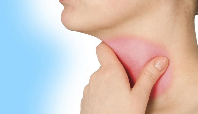 Galay Ki Kharash Ka Ilaj, Galay Ki Kharash Ka Ilaj - Kfoods