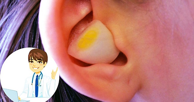 Benefits of Garlic in Ear, Benefits Garlic Ear - Kfoods